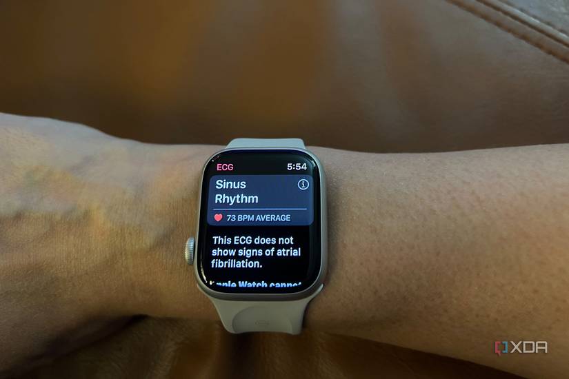 How to use ECG and check blood oxygen levels on Apple Watch