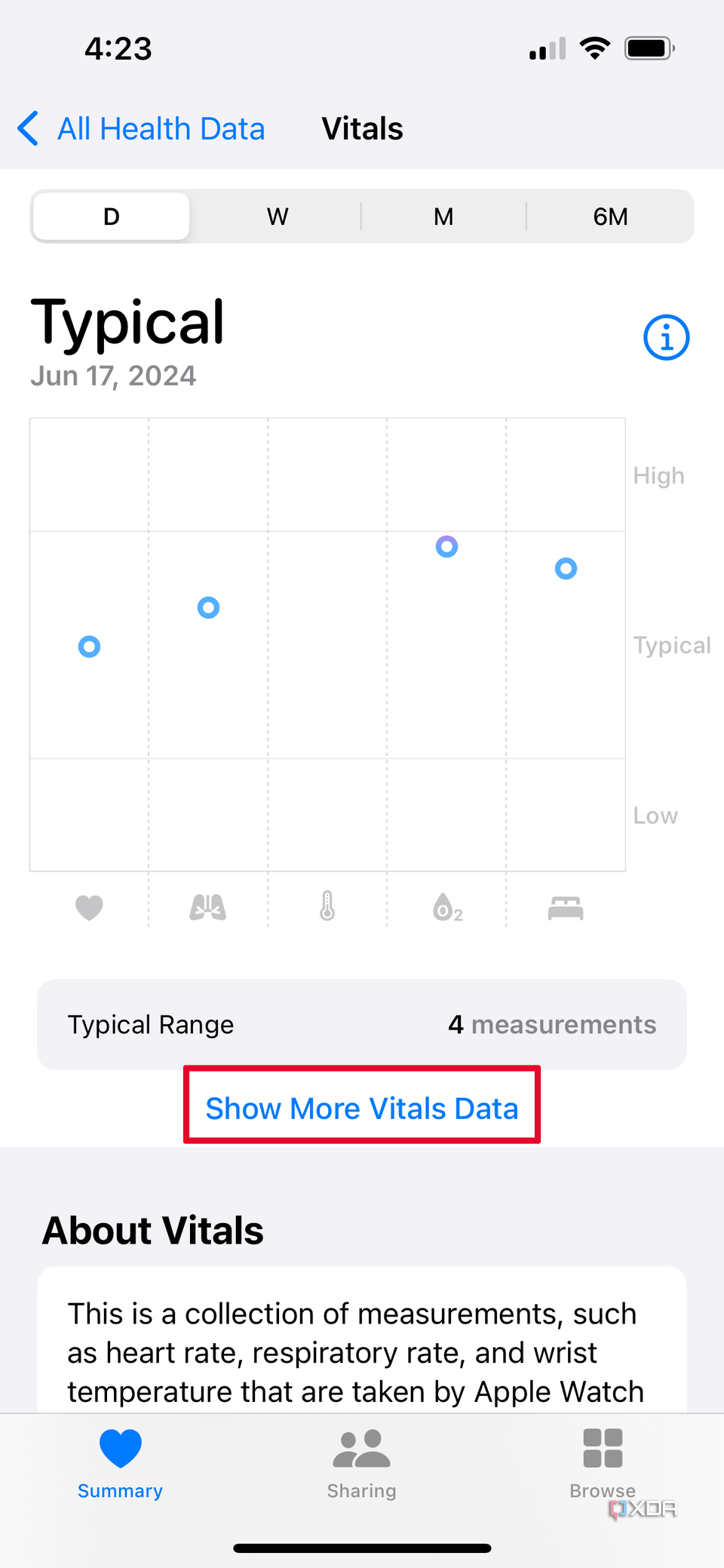 A complete guide to the Vitals app in watchOS 11