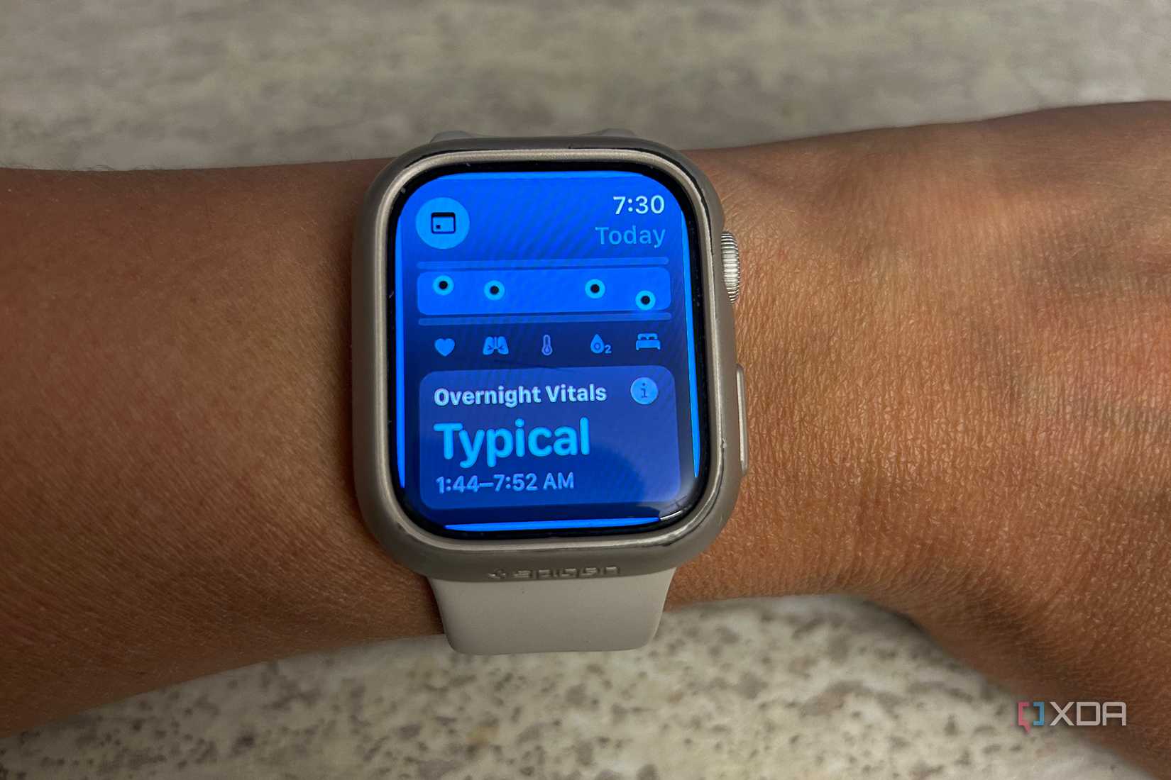 A complete guide to the Vitals app in watchOS 11